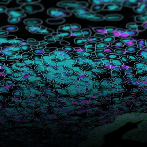 GeoMx Digital Spatial Profiler | NanoString