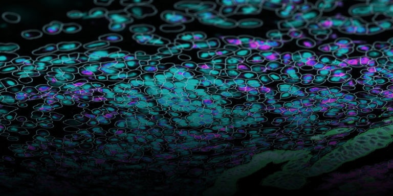 AtoMx™ Spatial Informatics Platform - NanoString