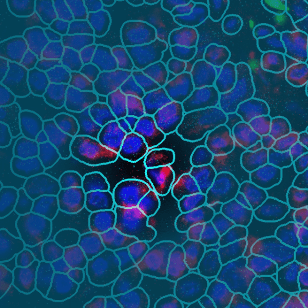 Research Focus | NanoString