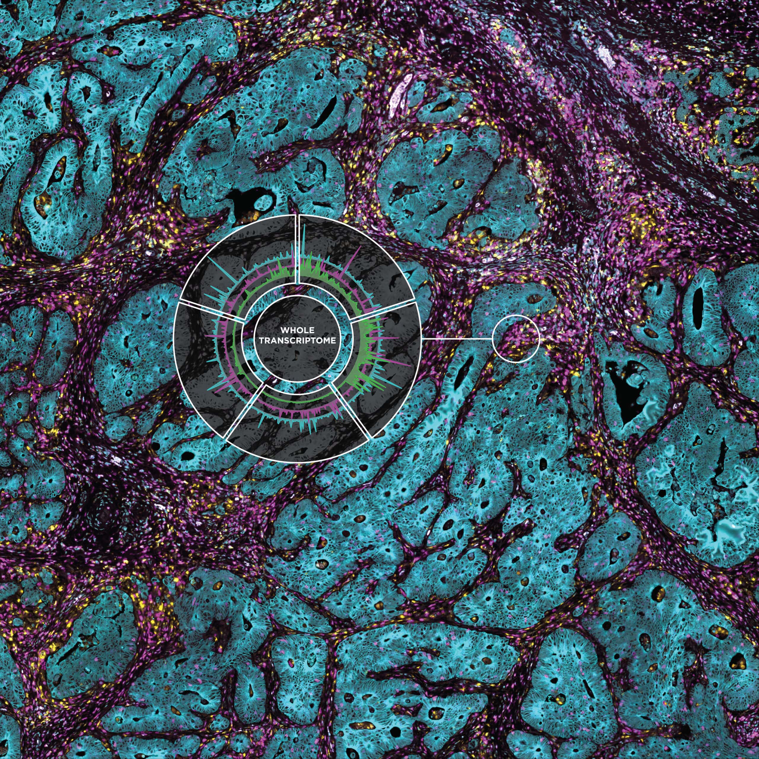 GeoMx® Cancer Transcriptome Atlas-Product Bulletin 日本語 | NanoString