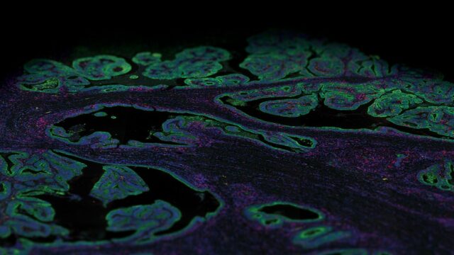 CosMx SMI Archives | NanoString