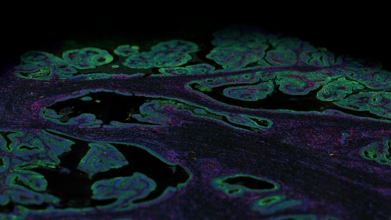 CosMx SMI Archives | NanoString