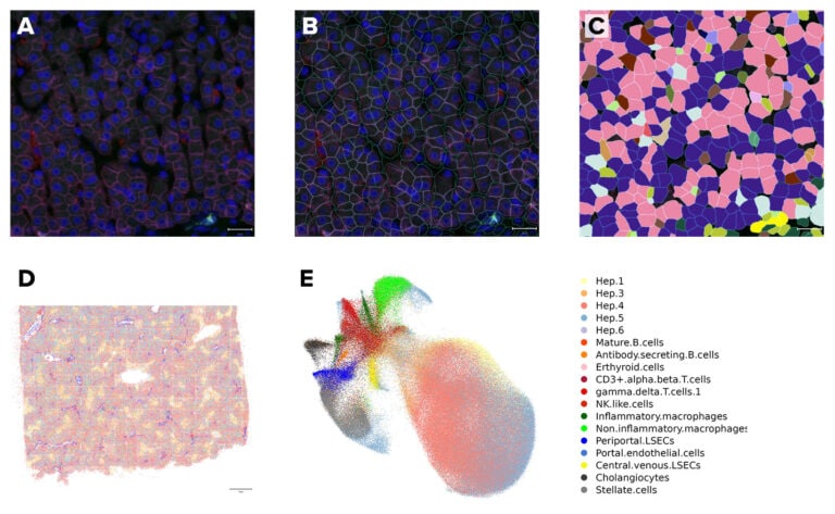 CosMx SMI Human Liver RNA FFPE Dataset | NanoString