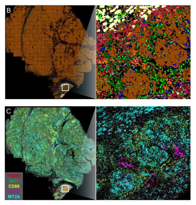CosMx SMI Human Liver RNA FFPE Dataset | NanoString