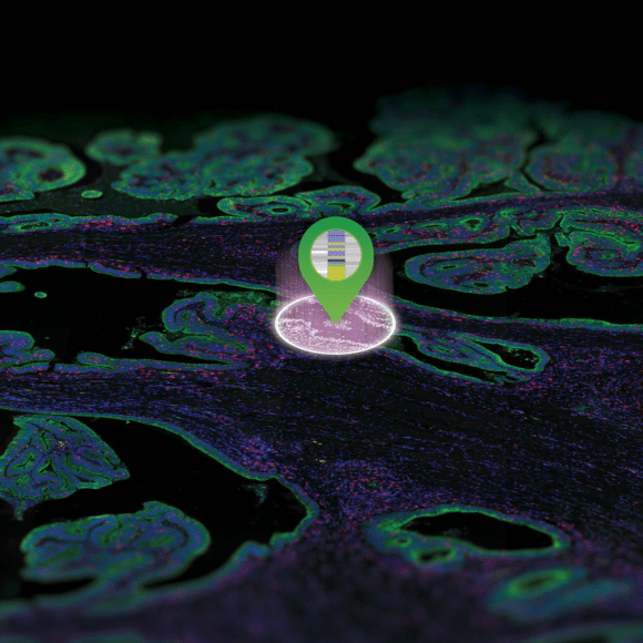 GeoMx DSP Archives | NanoString