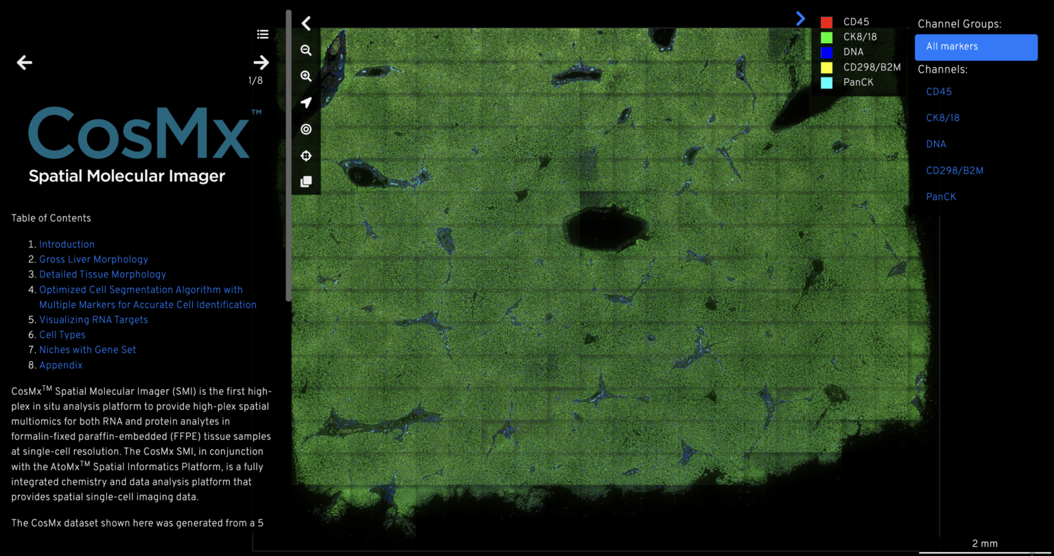 CosMx SMI Human Liver RNA FFPE Dataset | NanoString