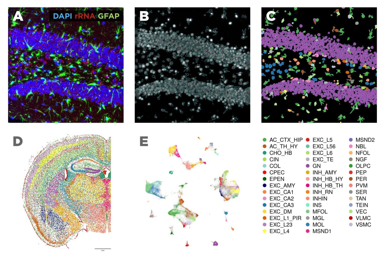 CosMx SMI Mouse Brain FFPE Dataset | NanoString