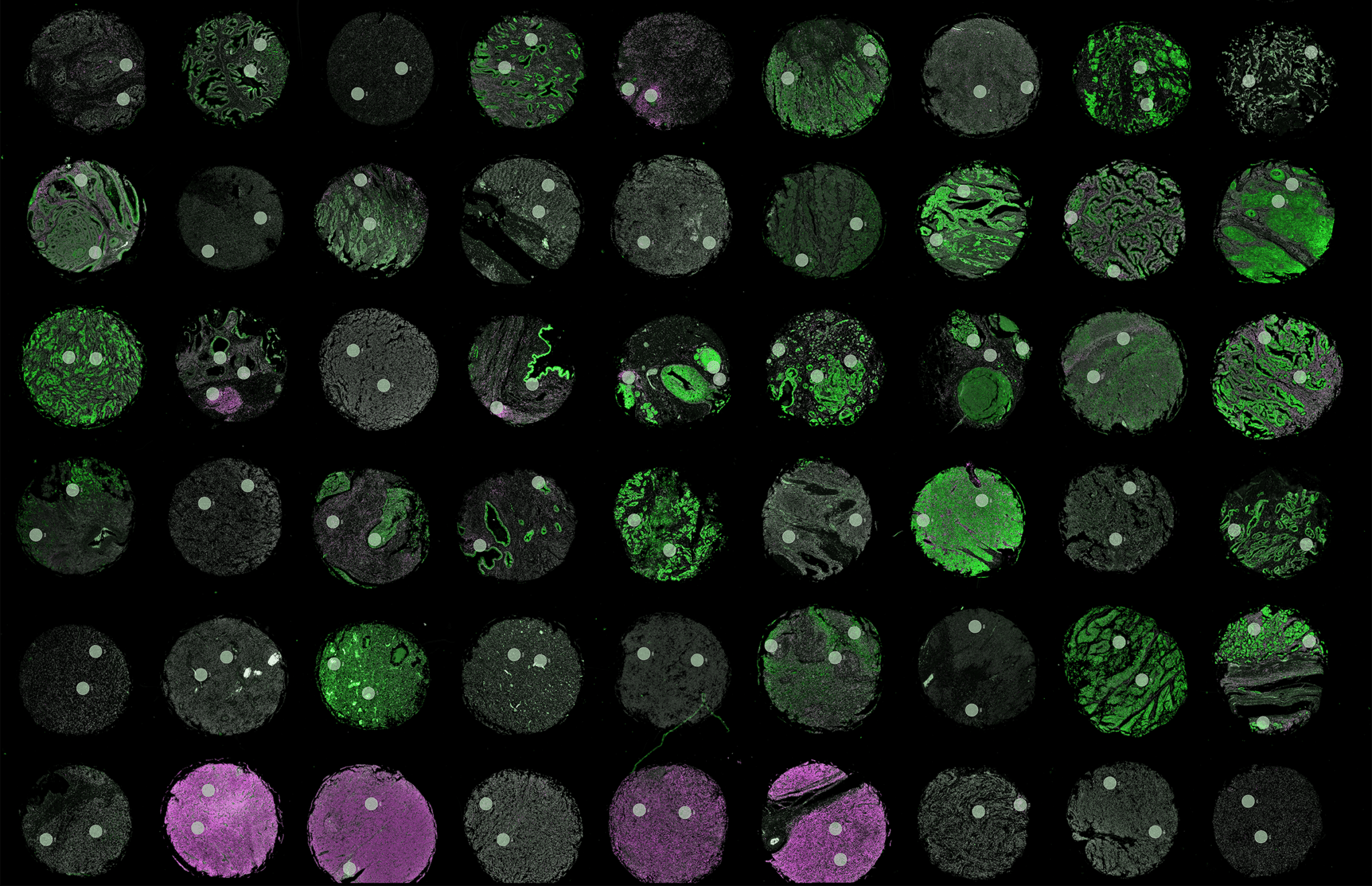 GeoMx® IO Proteome Atlas | NanoString