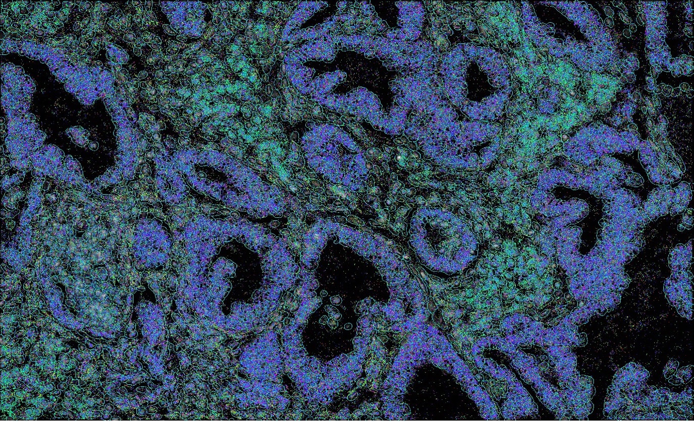 Technical Performance of Single-Cell Spatial Molecular Imaging