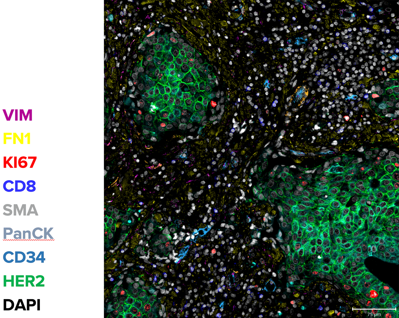 CosMx® Human Immuno-Oncology Protein Panel | NanoString