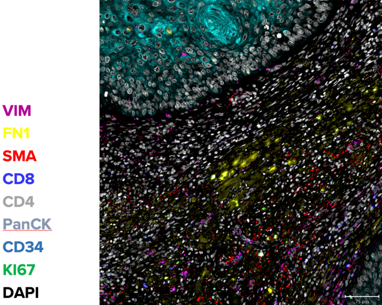 CosMx® Human Immuno-Oncology Protein Panel | NanoString