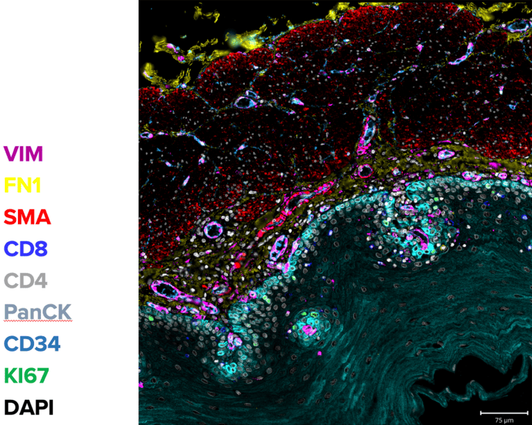 CosMx® Human Immuno-Oncology Protein Panel | NanoString