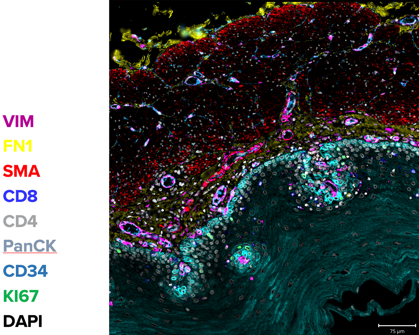 CosMx® Human Immuno-Oncology Protein Panel | NanoString