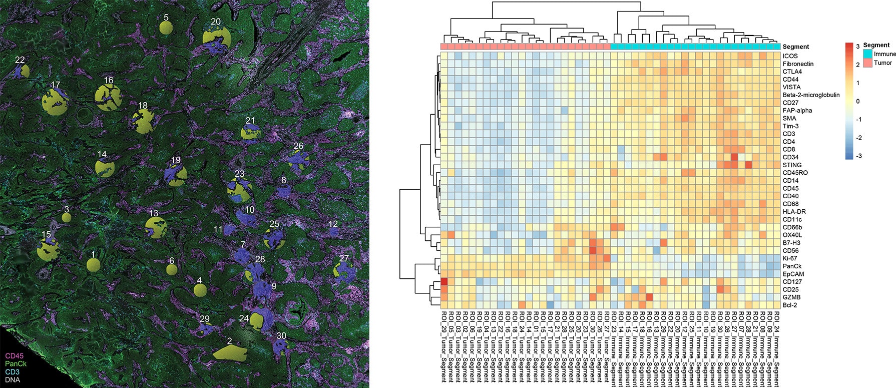 GeoMx® Immuno-Oncology Protein Panels | NanoString