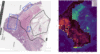 3 Tips for Successful CosMx Single-cell Spatial Runs at 1000 plex