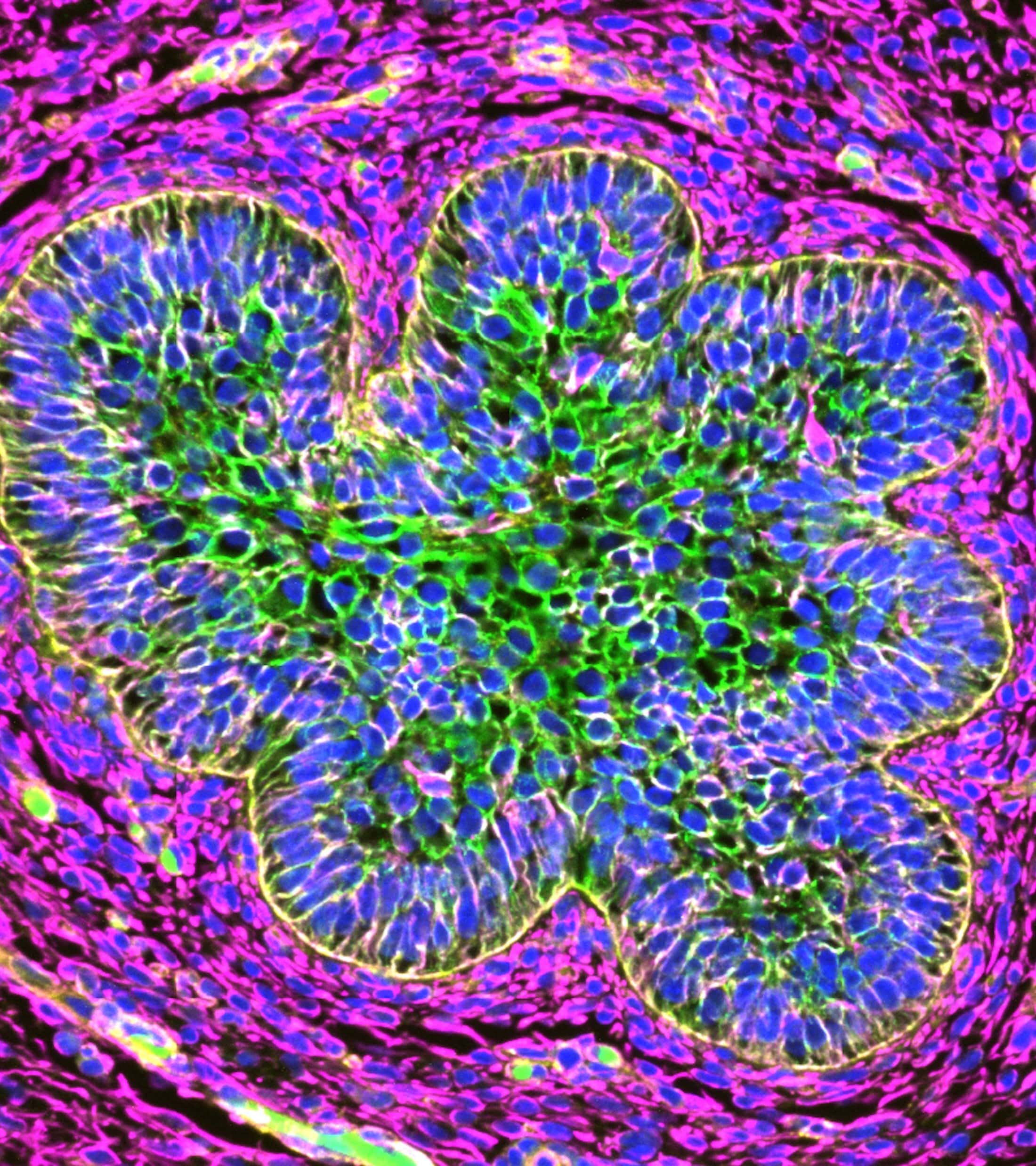 Blossoming Beginnings: Unveiling the Delicate Beauty of Mammary Buds ...