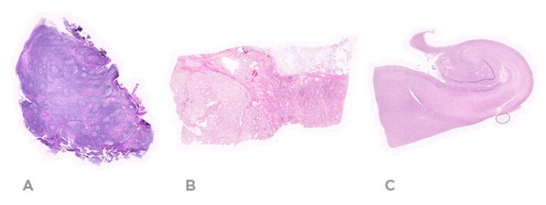Tips for Successful CosMx Single-cell Spatial Runs at 1000 plex
