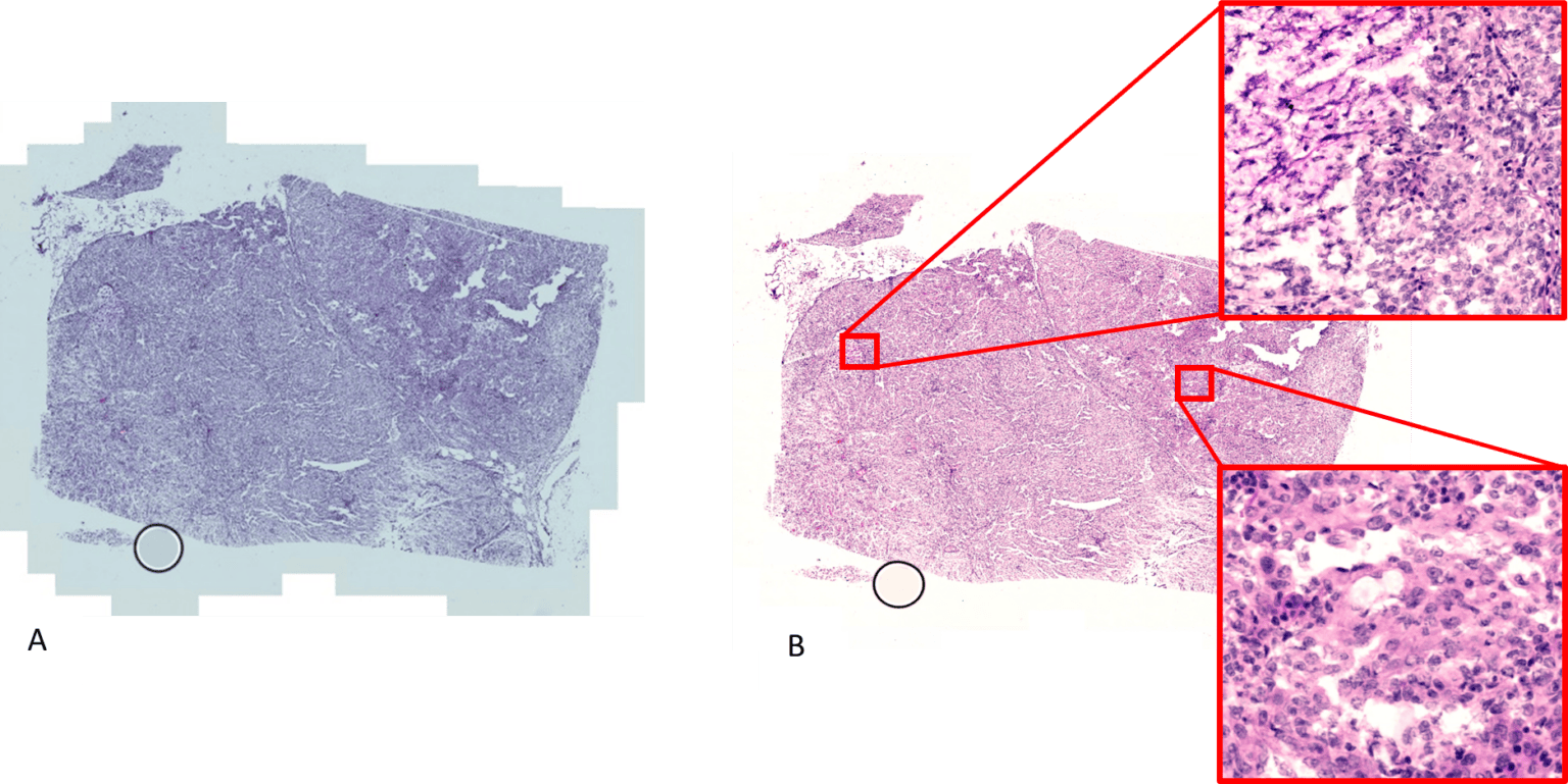 Tips for Successful CosMx Single-cell Spatial Runs at 1000 plex