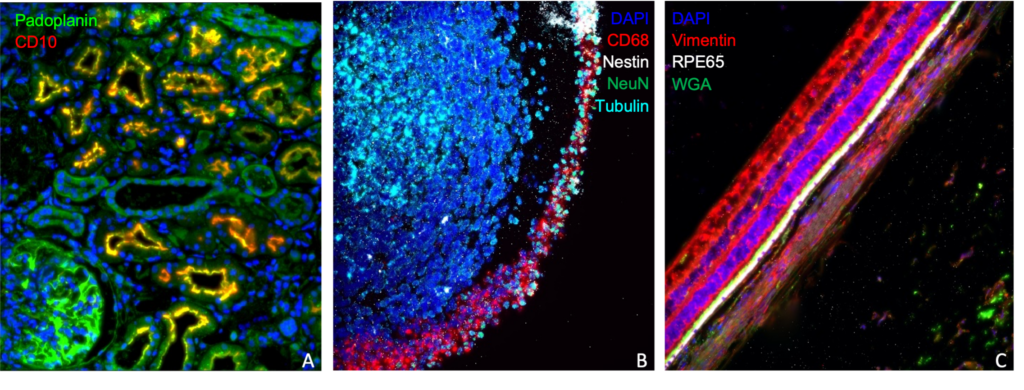 Tips for Successful CosMx Single-cell Spatial Runs at 1000 plex