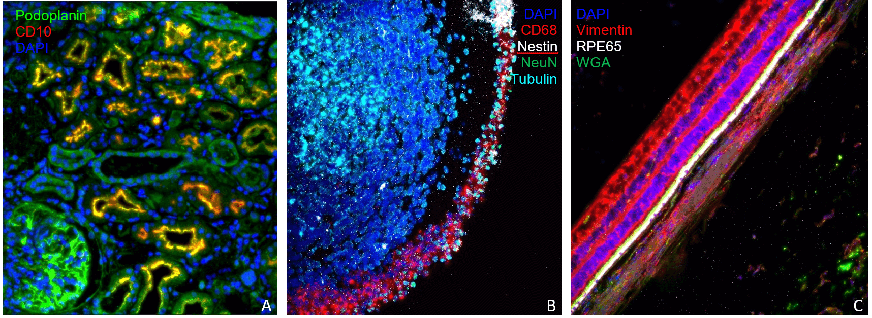 Tips for Successful CosMx Single-cell Spatial Runs at 1000 plex