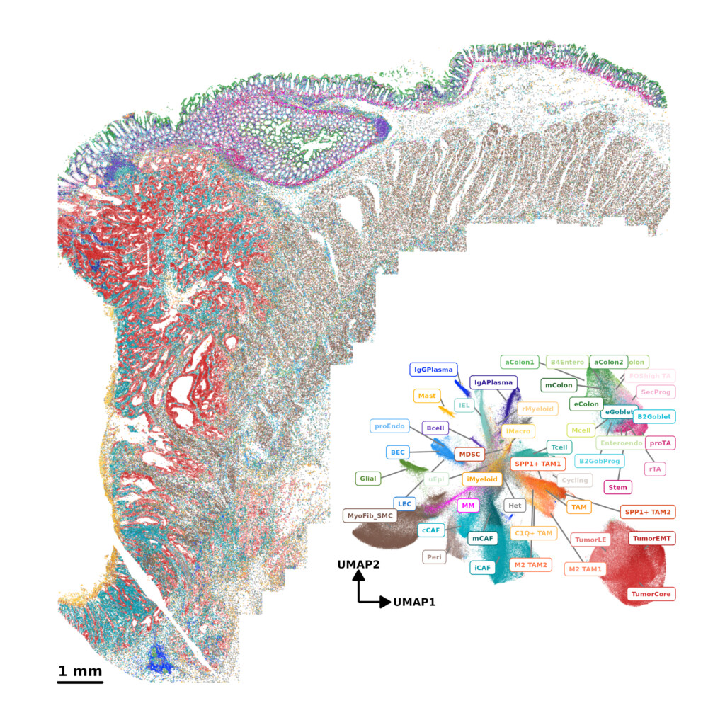 CosMx® Human Whole Transcriptome Colon Dataset | NanoString