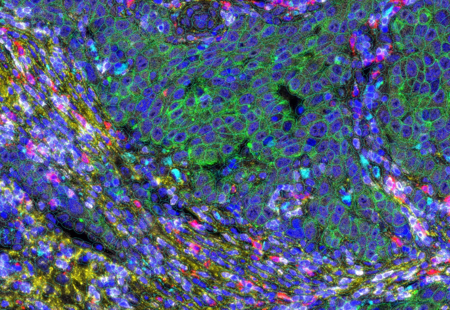 Why Transcriptomics Matters: Understanding the Value of High-Resolution Spatial Molecular ...