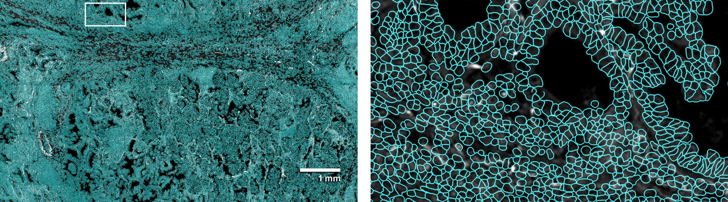 CosMx SMI Overview - Single-Cell Imaging - NanoString
