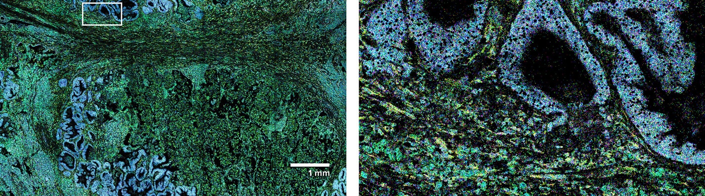 CosMx SMI Overview - Single-Cell Imaging - NanoString