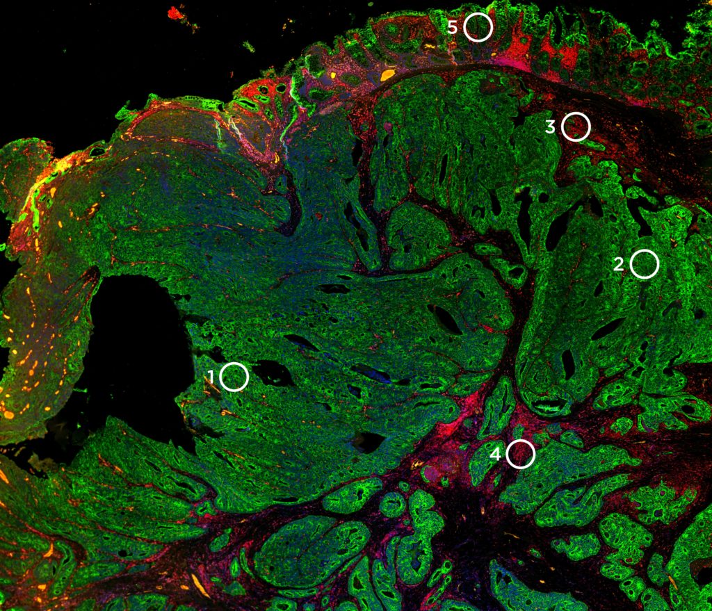 GeoMx DSP Archives | NanoString
