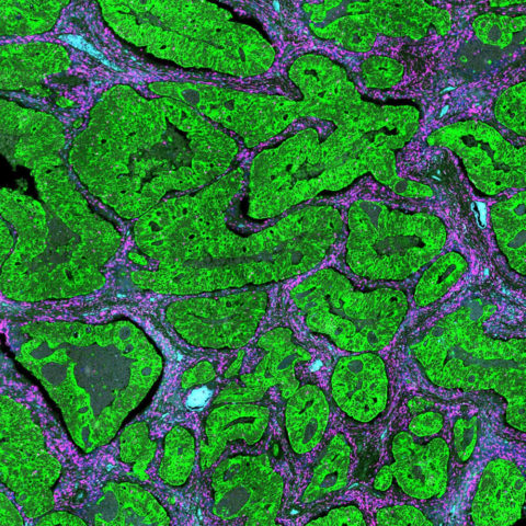 GeoMx Digital Spatial Profiler | NanoString