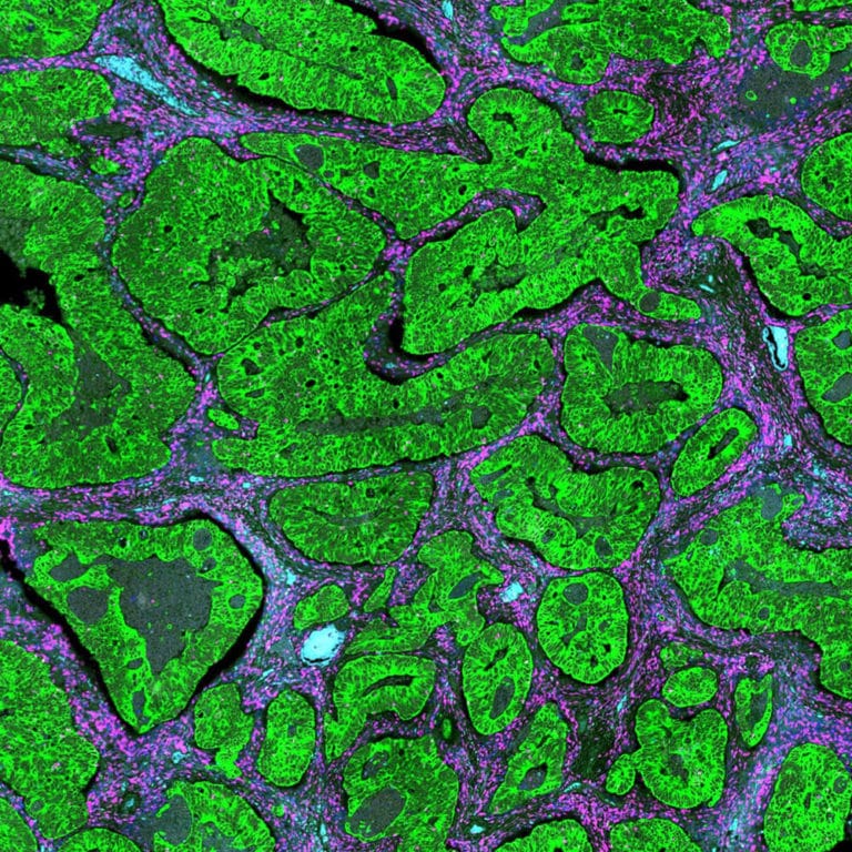 GeoMx Digital Spatial Profiler | NanoString