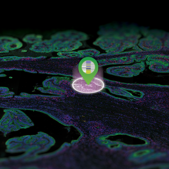 GeoMx DSP Spatial Genomics Overview - NanoString