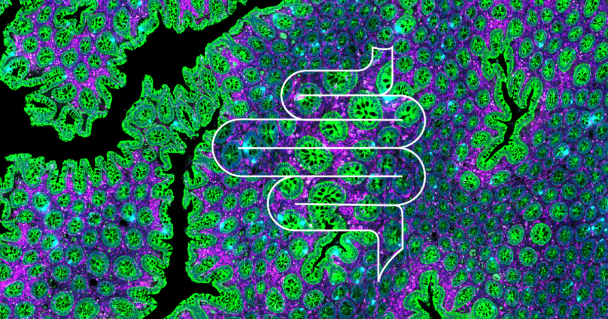 Human Colon | NanoString