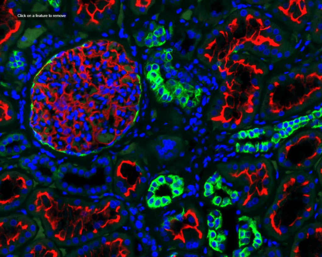 Multiomics Spatial Analysis Archives | NanoString