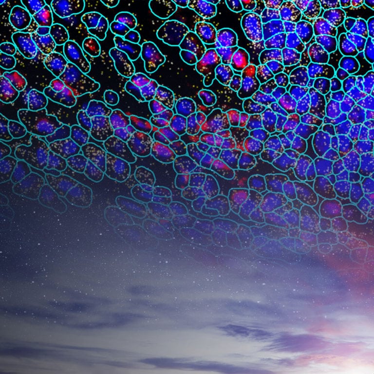 CosMx Spatial Molecular Imager | NanoString