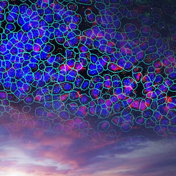 CosMx SMI Human Pancreas FFPE Dataset | NanoString CosMx SMI Human Pancreas FFPE Dataset | NanoString