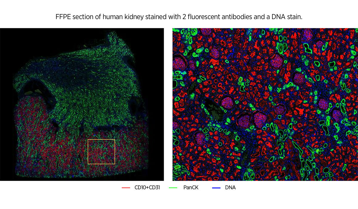 GeoMx Morphology Markers | NanoString
