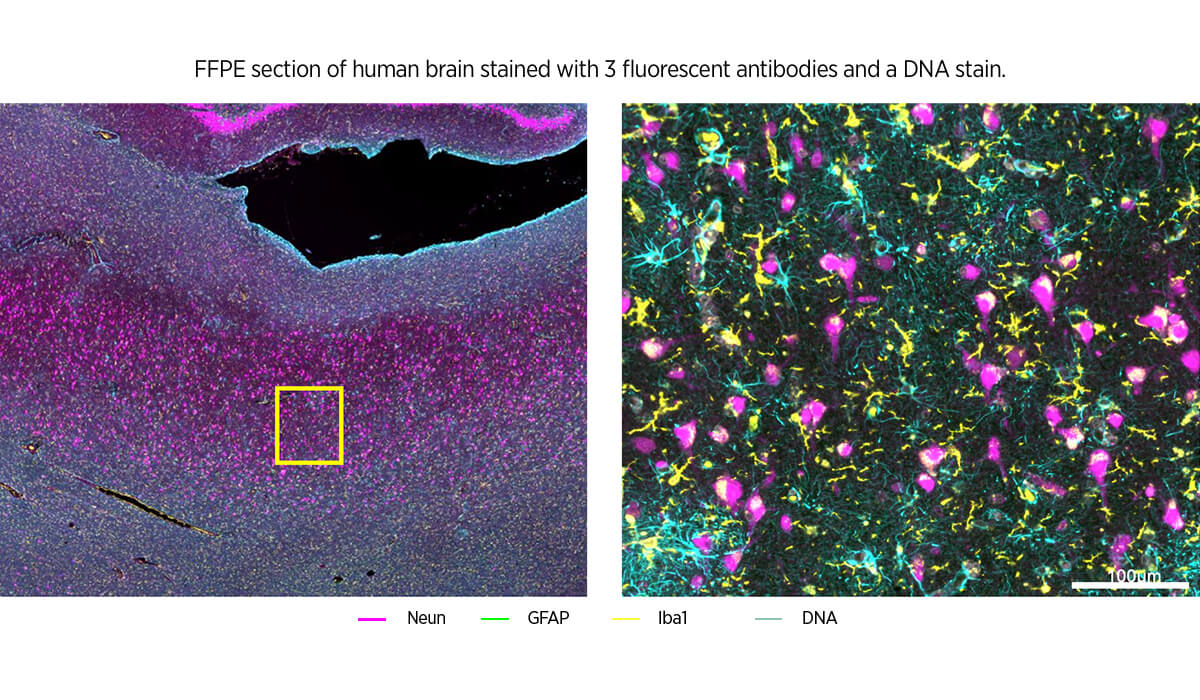 GeoMx Morphology Markers | NanoString