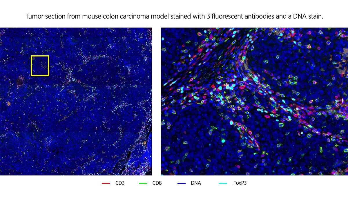 GeoMx Morphology Markers - NanoString