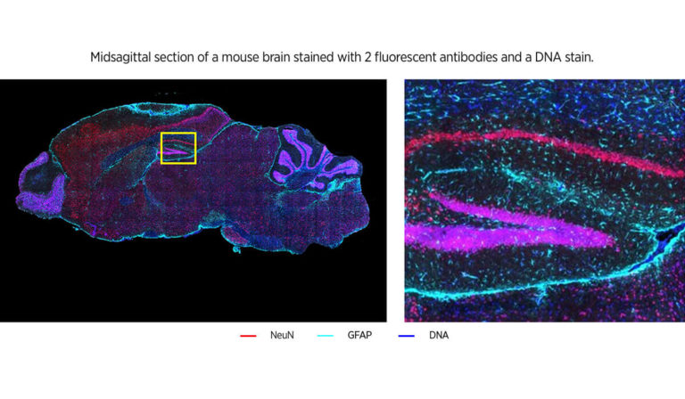 GeoMx Morphology Markers | NanoString