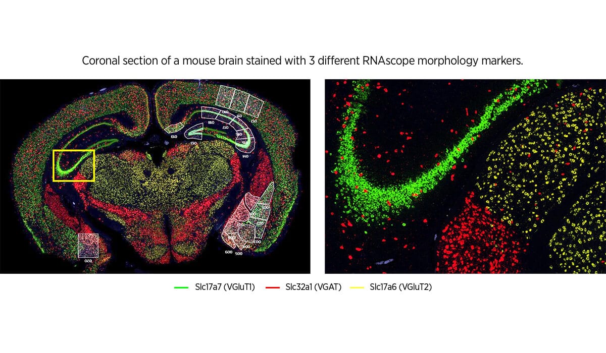 GeoMx Morphology Markers | NanoString
