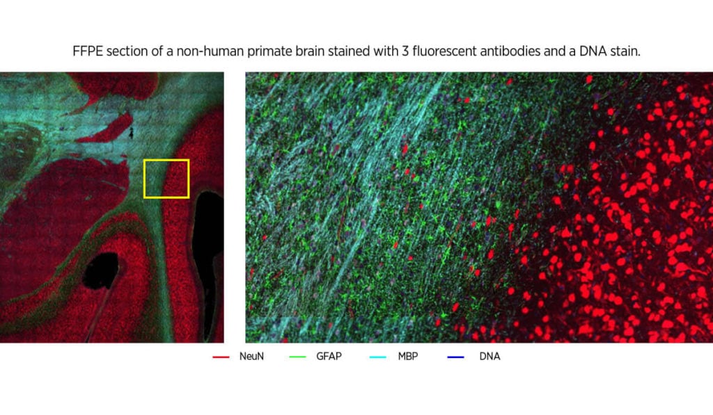GeoMx Morphology Markers - NanoString