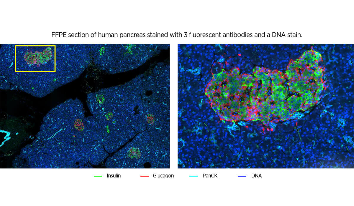 GeoMx Morphology Markers | NanoString
