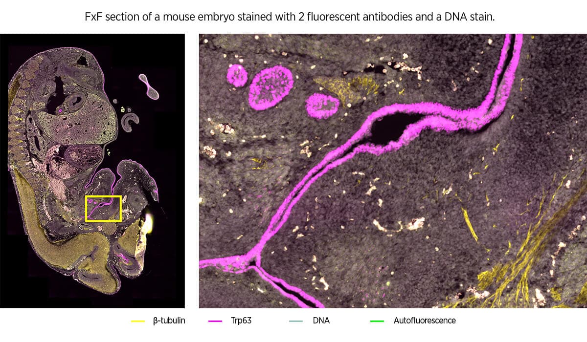 GeoMx Morphology Markers | NanoString