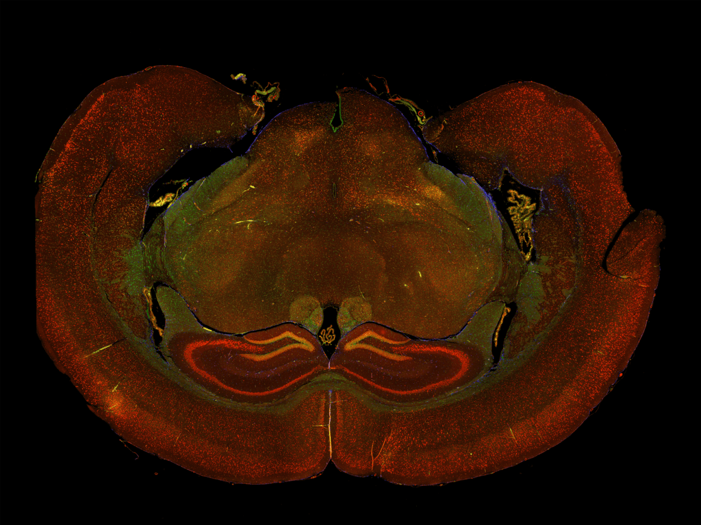 CosMx® Mouse Neuroscience Protein Panel | NanoString