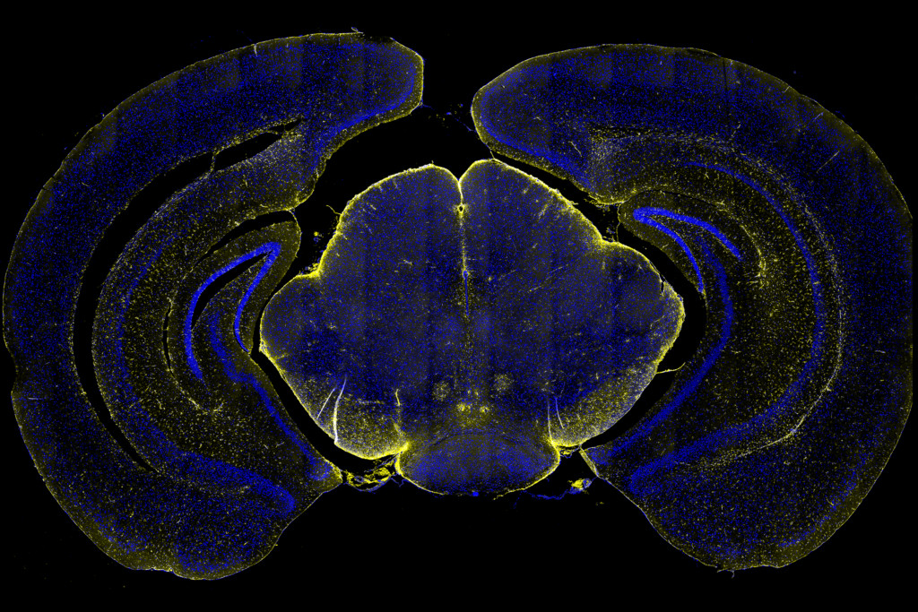 GeoMx DSP Neuroscience Whole Transcriptome Atlas Grant | NanoString