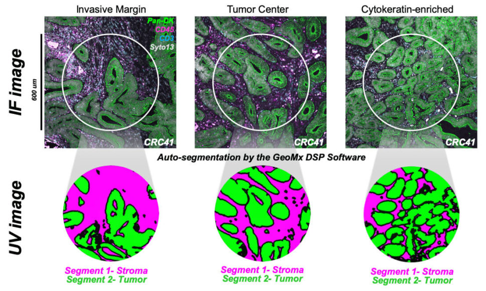 The most flexible spatial solution- GeoMx® DSP
