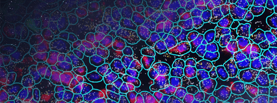 NanoString: The Leader in Spatial Biology