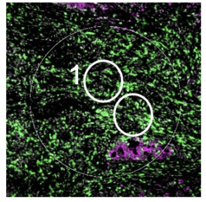 GeoMx DSP Spatial Genomics Overview | NanoString