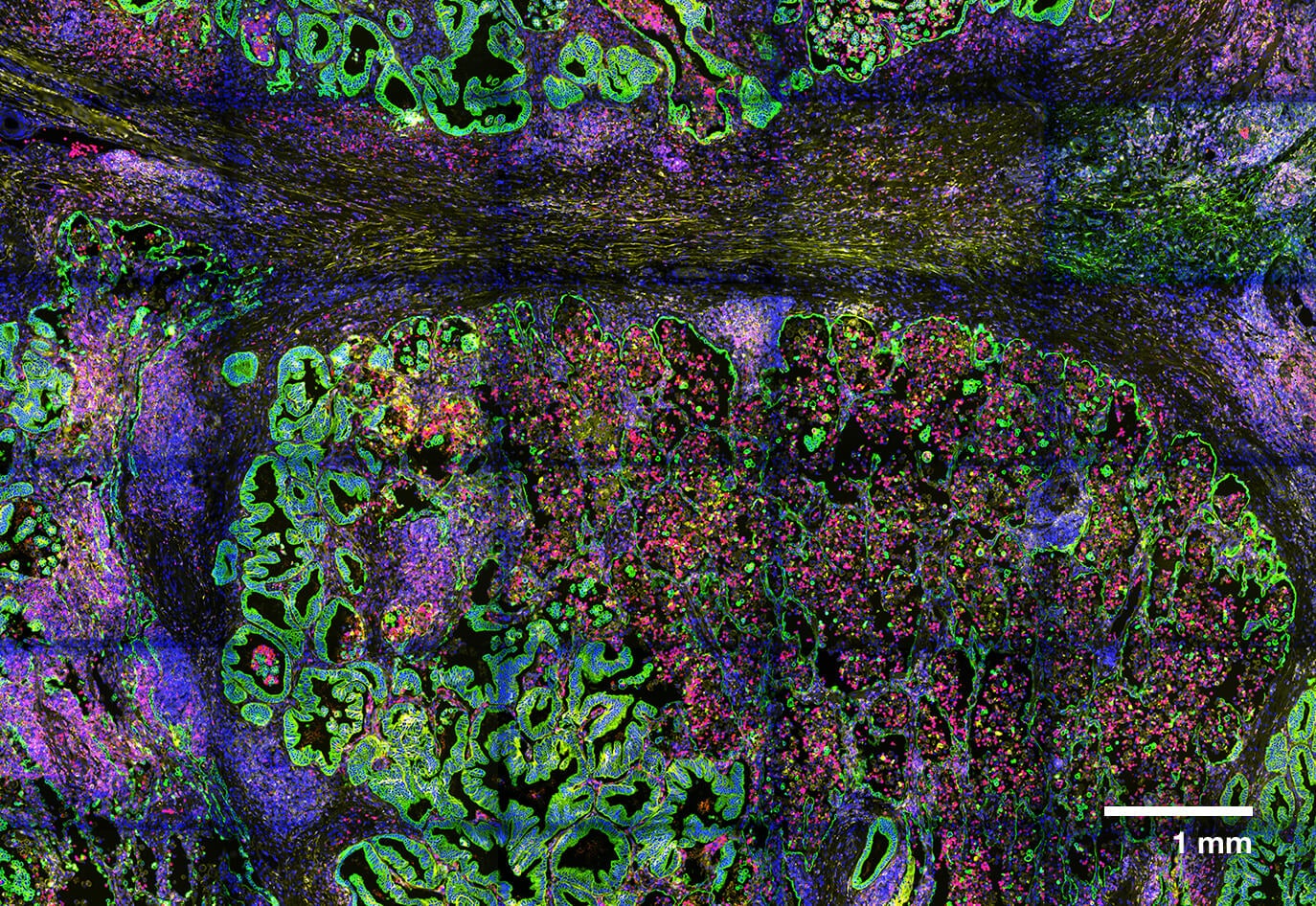 Spatial Proteomics GeoMx Grant for Central and Eastern Europe | NanoString